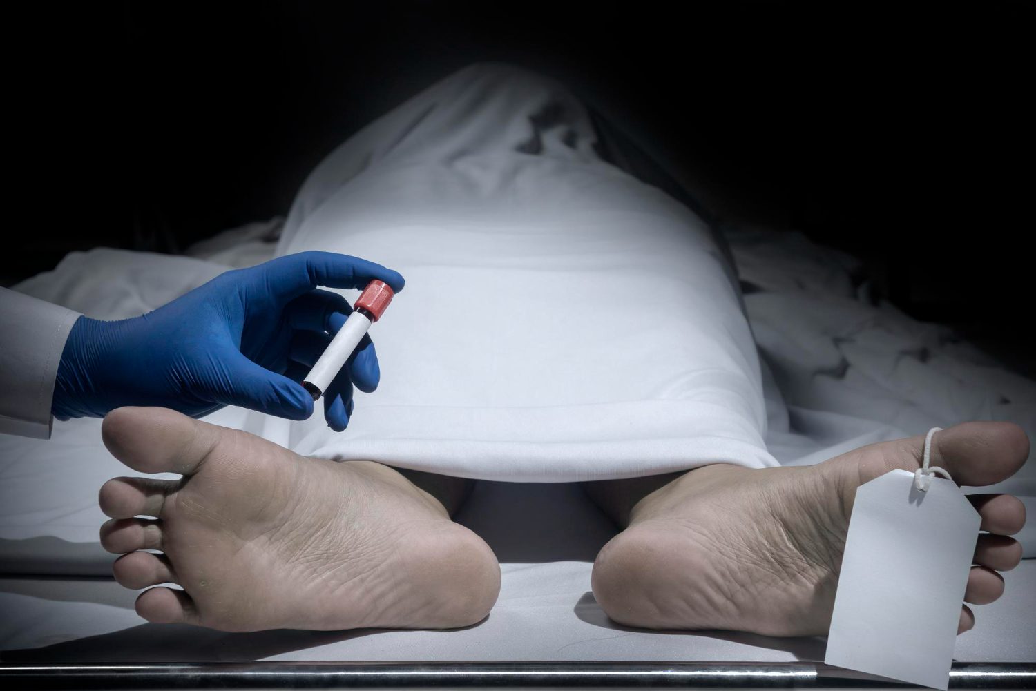 Evaluating the Right Time for a Partial Autopsy